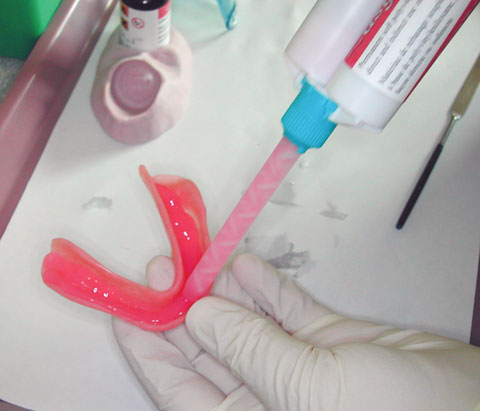 Clinical Application - Easy Soft Liner